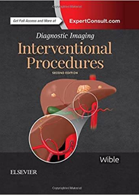 (eBook PDF)Diagnostic Imaging: Interventional Procedures 2nd Edition by ...